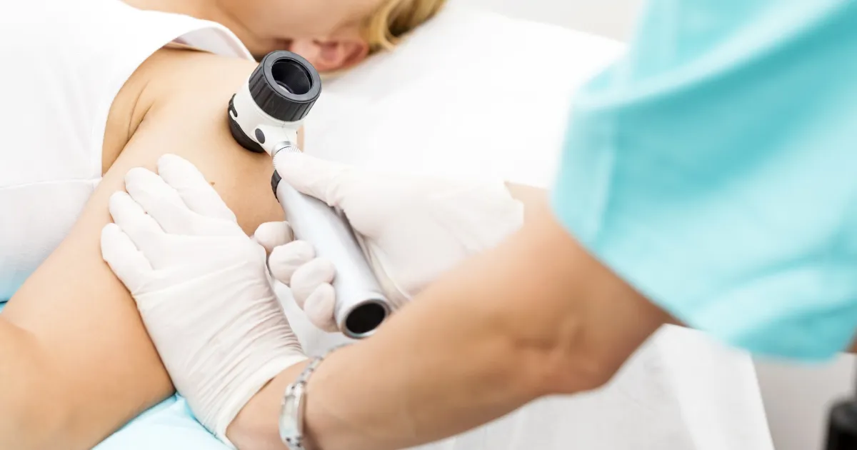 Five Questions On Skin Cancer, Answered | South Shore Health